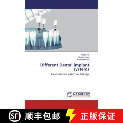 预订 Different Dental implant systems [9786200473691]