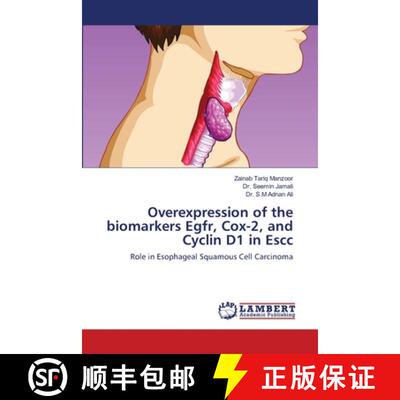 预订 Overexpression of the biomarkers Egfr, Cox-2, and Cyclin D1 in Escc [9786139814138]