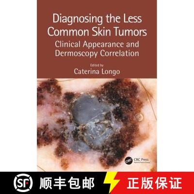 【3-4周达】精装 Diagnosing the Less Common Skin Tumors: Clinical Appearance and Dermoscopy Correlation [9781138106628]