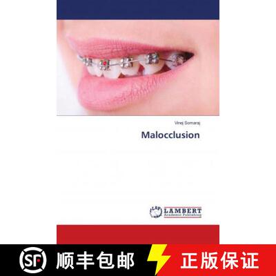 预订 Malocclusion [9786139891399]