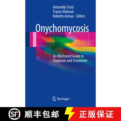 【3-4周达】Onychomycosis : An Illustrated Guide to Diagnosis and Treatment [9783319448527]