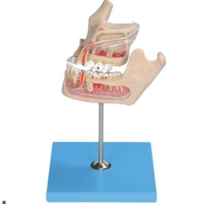 牙体病变f模型B10016