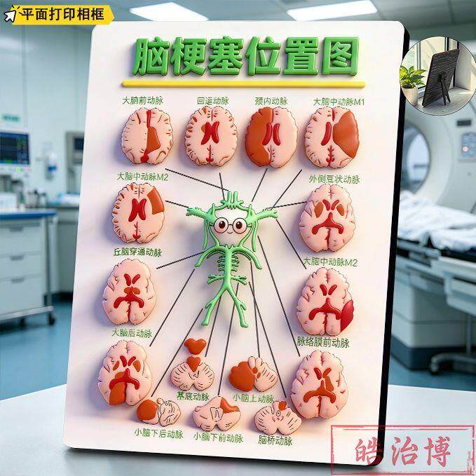 脑梗塞位置图解相框脑血管供血区解剖示意图医学生神经内科画框