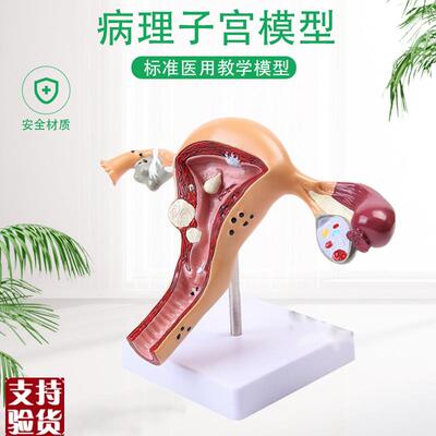 女病理子宫模型女妇o产子宫结构解剖高级仿真病态子宫模型包邮