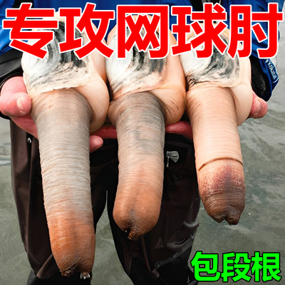 【小红书推荐】重症网球肘胳膊肘外侧关节疼痛压痛肌腱损握物无力