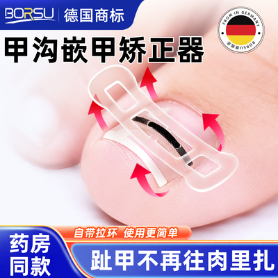 【易拉环专利】使用便捷科学矫正