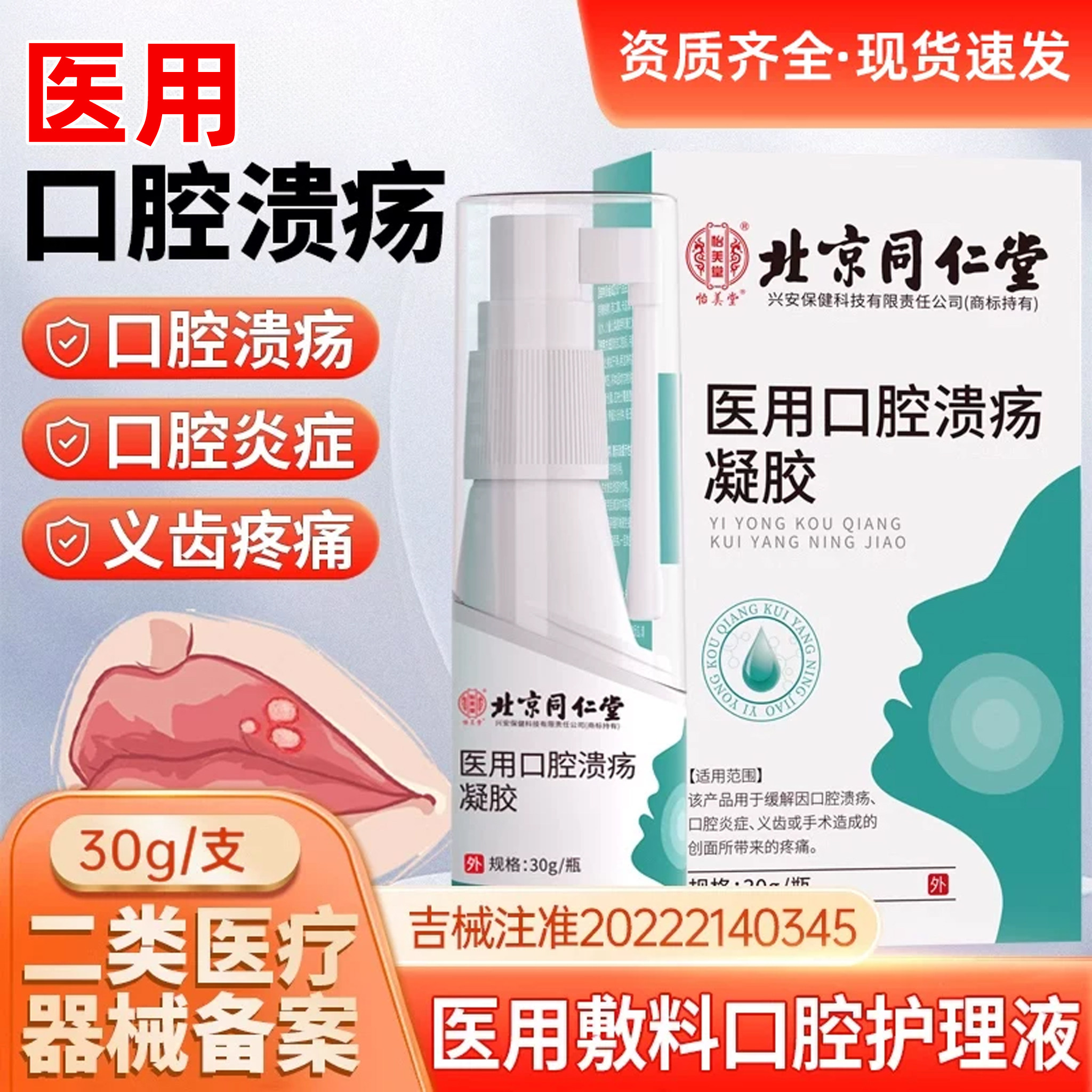 医用口腔溃疡喷雾专用舌头嘴巴上火起泡疼痛口疮儿童凝胶剂保护