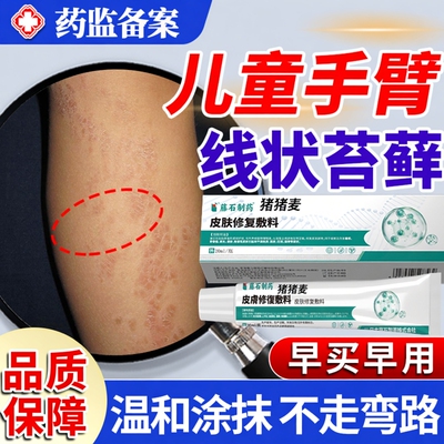 儿童手臂线状苔藓】用它不走弯路