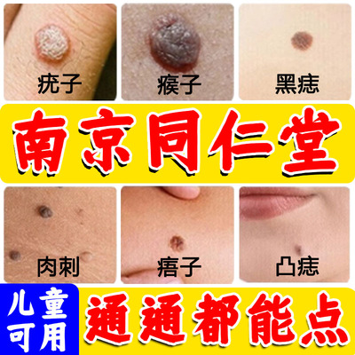 点痣膏去痣点斑正品药膏祛痣药水去除黑痣痦子不留疤旗舰店无痕