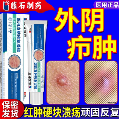 外阴火疖子私处疖肿搭拔毒拔脓药膏屁股长痘皮脂腺囊肿毛囊硬块QN