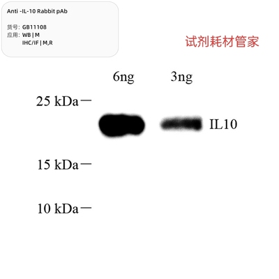 Anti-IL-10 Rabbit pAb,抗IL-6兔pAb,Il-10兔polyclonal antibody