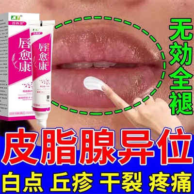 皮脂腺异位症嘴唇白点唇愈膏增生干裂起泡脂肪小颗粒唇炎去除神器