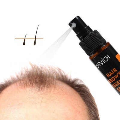 30ml Hair Natural Faster Growing Spray Hair Loss treatment