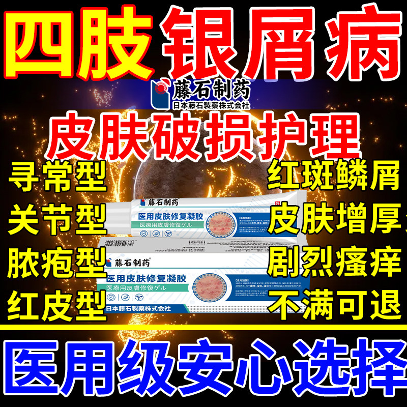 四肢牛皮藓银屑病皮肤破损可搭膏药贴顽固牛皮癣进口手肘癣鳞屑SE