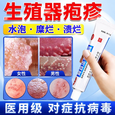[太平]阿昔洛韦乳膏3%*10g*1支/盒
