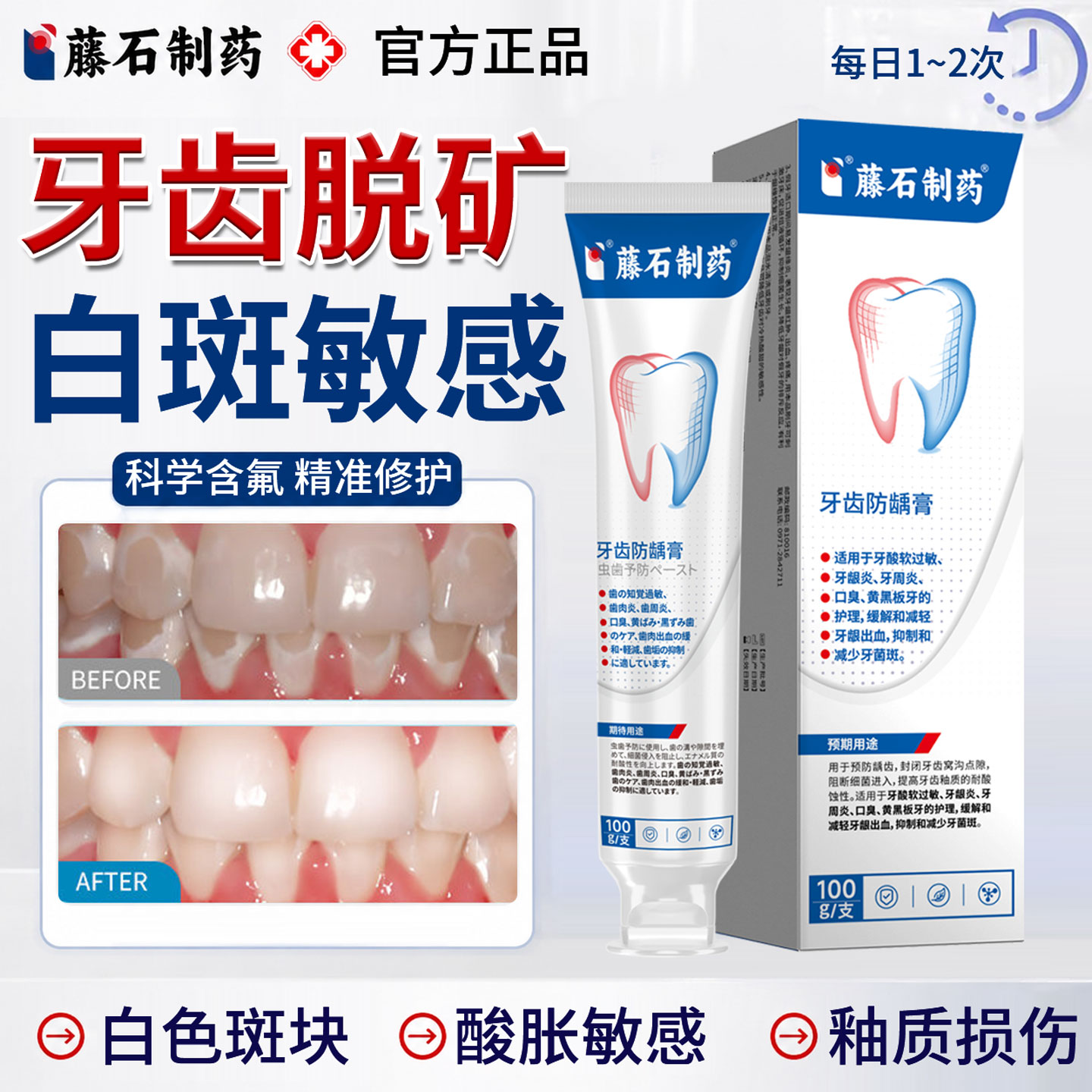牙齿脱矿白斑钙化专用护牙素儿童成人牙膏含氟再矿化修复牙釉质YZ
