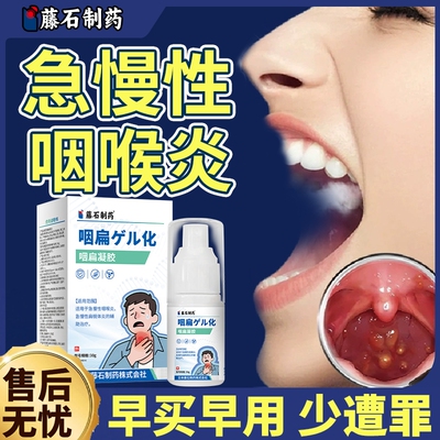 会厌囊肿咽喉炎异物感有痰声带小结息肉 滤泡增生搭喷雾剂去除EM