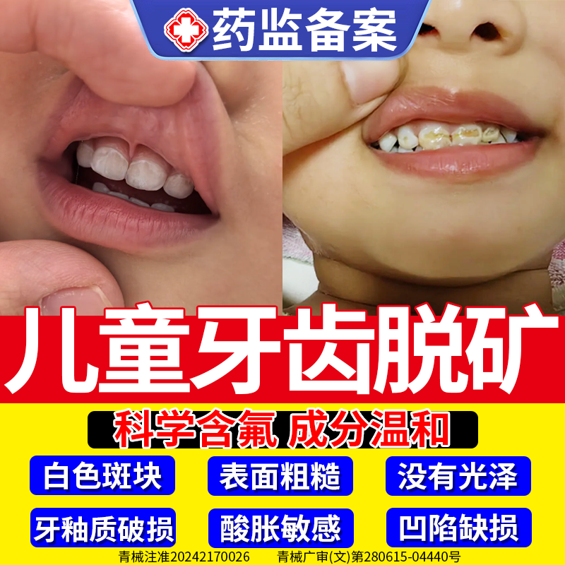 儿童牙齿脱矿防白斑钙化再矿化护牙素修复含氟非牙膏专用牙釉质JW