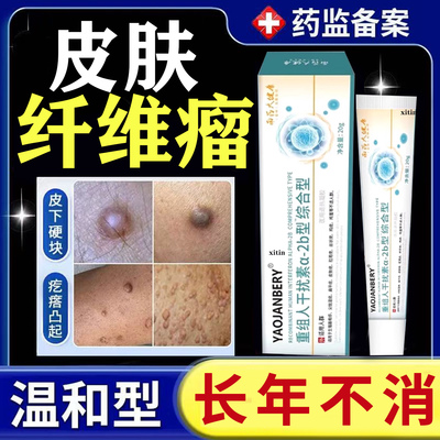 皮肤纤维瘤消瘤膏去除药膏肿硬块疙瘩结节皮下粉瘤脂肪瘤贴神器TT