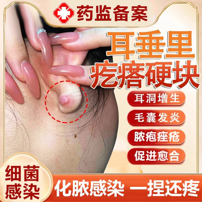 耳洞增生疙瘩硬块皮脂腺囊肿软膏