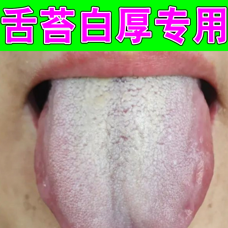 舌苔白厚舌头有裂纹发热舌苔白又厚口腔发麻地图舌舌调理舌面萎缩