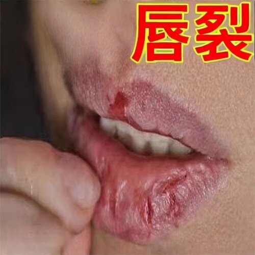 唇膏专用修护嘴唇干裂脱皮润唇膏嘴角嘴皮开裂结痂出血膏