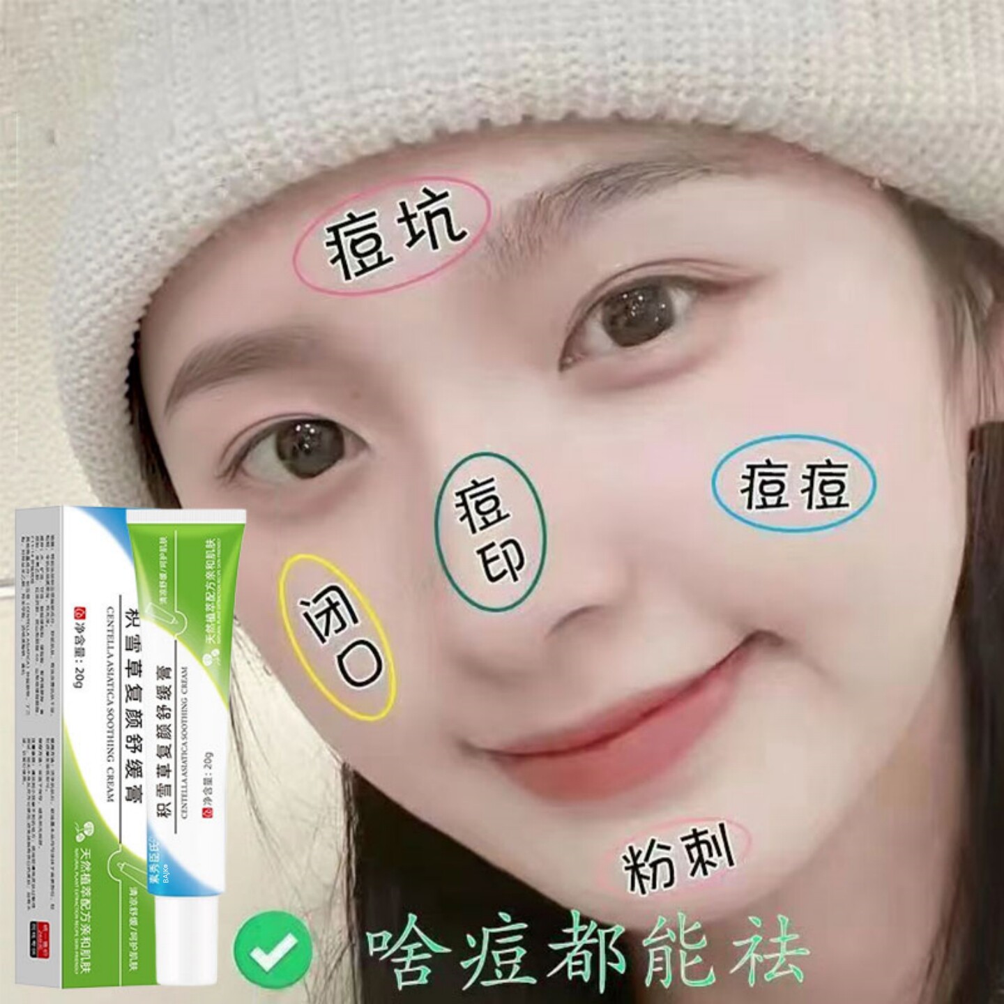 积雪草苷霜软膏祛痘印坑淡化黑色素沉淀官方旗舰店正品消红复颜乳