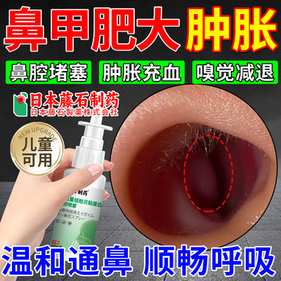 鼻甲肥大肿胀专用喷剂特消炎修复效儿童鼻炎鼻塞通气可搭膏药贴OM