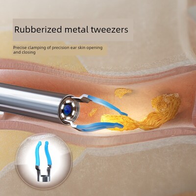 bebird智能视觉耳勺独家耳勺头配件[Bebird3Plus专用,而不是产品