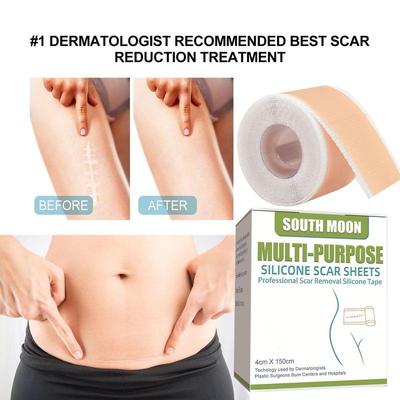 Silicone Scar Sheets 1.5m Self Adhesive Scar Tape Roll Elast