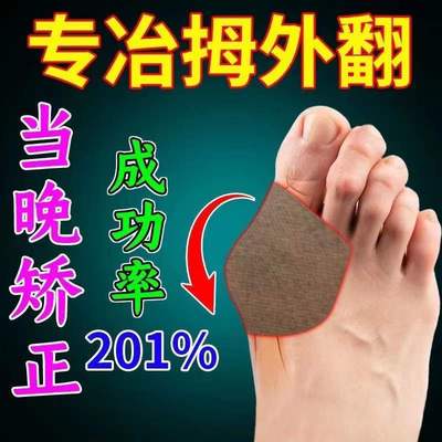【包冶好】严重拇指外翻矫正神器女大脚拇指外翻脚趾重叠疼痛膏贴