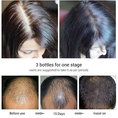 好货Hair Growth Oil Hair Loss Thinning Haircare Serum Baldne