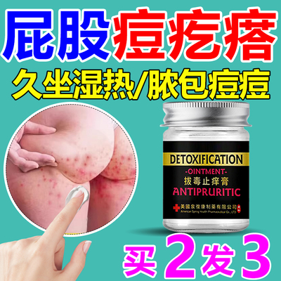 屁股上长痘痘痒起热疙瘩