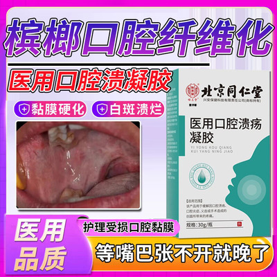 口腔溃疡凝胶嚼槟榔口腔黏膜纤维化修复舌头扁平苔藓非专用膜药HX