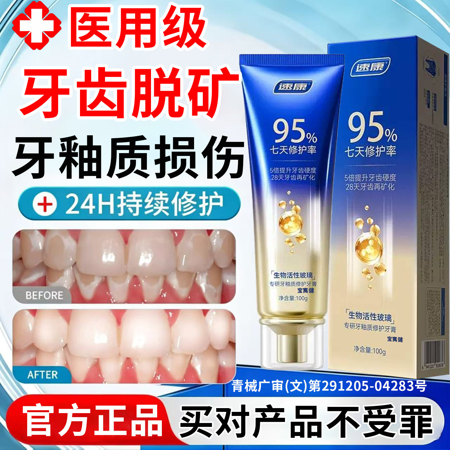 牙齿脱矿膏修复牙釉质含氟防白斑钙化再矿儿童成人专用补矿护牙素