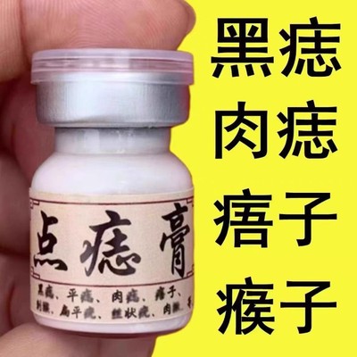 点痣膏无痕正品脸部点痦子取痣去黑痣辅助点痣药水神器仪黑点去除