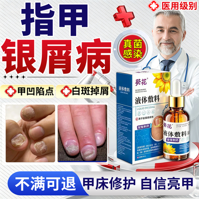 银屑病甲灰指甲专发黄增厚变白用手指甲真菌感染空甲修复液药水KY