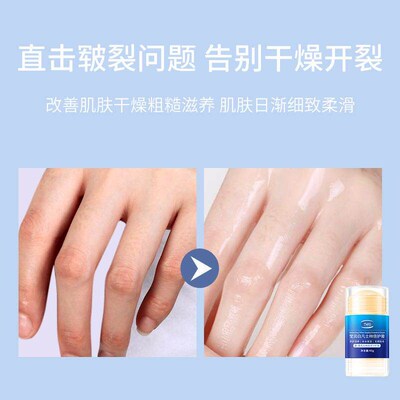 Heel dryness and cracking prevention cream, hand and foot ch
