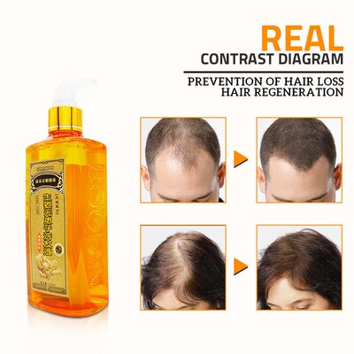 300ml Ginger Shampoo Anti-hair Loss Baldness And Dandruff Ef