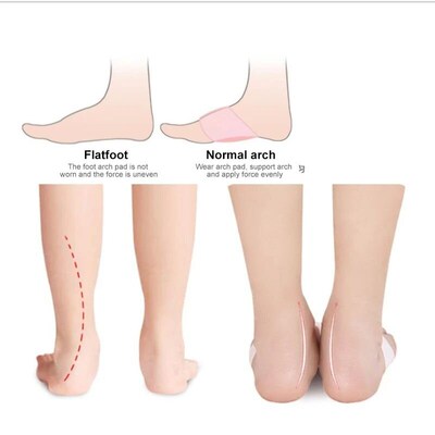 2Pcs/Pair Foot Arch Support Pad Silica Gel Plantar Protectio