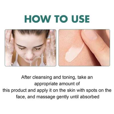 Niacinamide Melasma Brightening Cream Reduce Melanin Lighten