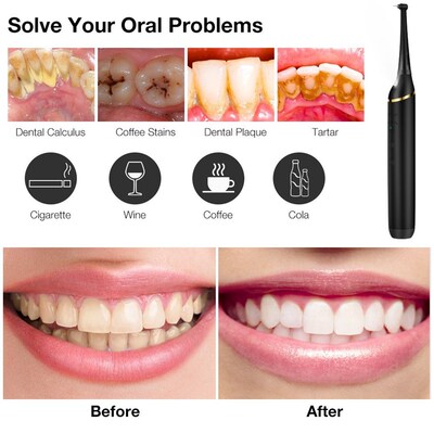 Portable Electric Sonic Dental Scaler Tooth Calculus Remover