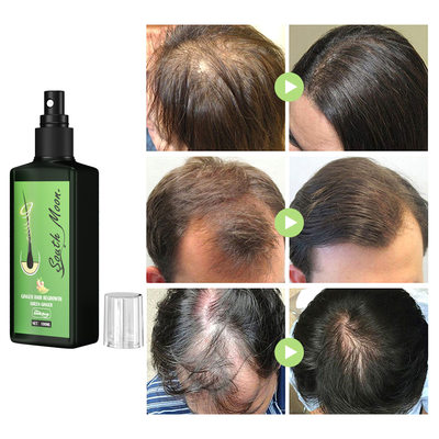 Ginger Hair Growth Hair Loss Essential Oil Fast Growing