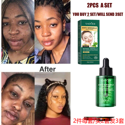 RemoveWrinkleSerum液态精华油