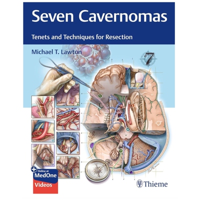 Seven Cavernomas 七个海绵状瘤 9781684204946