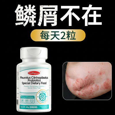 皮肤敏敏牛皮鳞屑内调皮损呵护肌肤自然片剂泛红干燥皮肤
