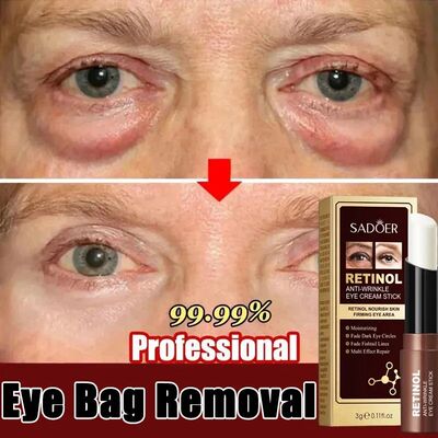 Retinol Anti-wrinkle Eye Cream Remove Eye Bags Dark Circles
