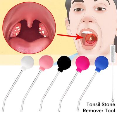 Tonsil Stone Remover Tool Manual Style Remover Mouth Cleanin