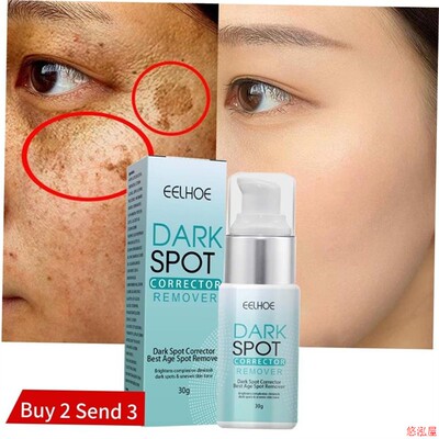 Nicotinamide Whitening Freckle Cream Dark Spot Remover Skin