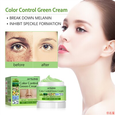 Whitening Freckles Cream Remove Melasma Dark Spot Lightening
